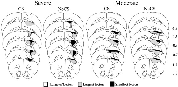 Motor Lesions, Neuroscience, Assignment Help