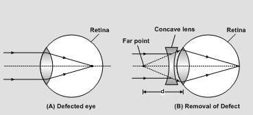 Defects in eye, Assignment Help, Optical instruments