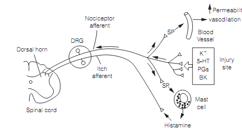 Peripheral Sensitization, Pain pathology, Assignment Help